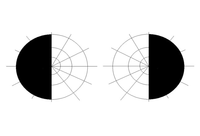 Hinweise im Auge: 11 opthalmologische Befunde, die Neurologen bei der ...