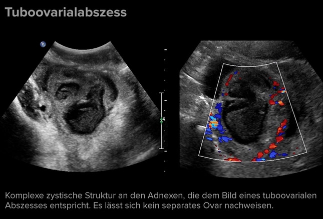 Sonografie: 10 Diagnosen, die Sie nicht übersehen sollten