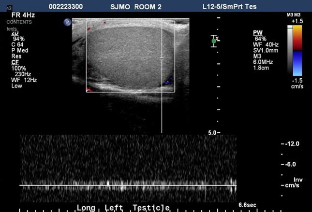 Hodentorsion, Vorhaut-Ödeme, Dauererektion und andere urologische ...