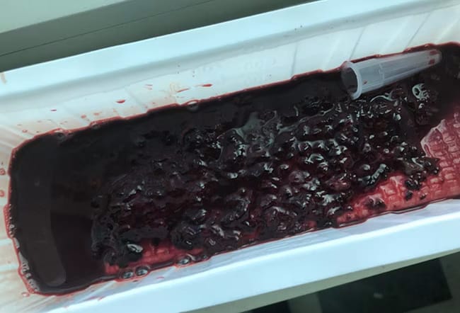Diashow: Rot, violett, grün – harmlos oder krank? Was verfärbter Urin ...