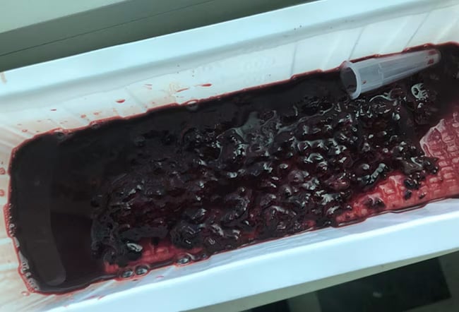 Diashow: Rot, violett, grün – harmlos oder krank? Was verfärbter Urin ...