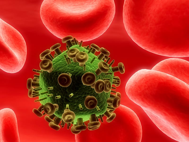 Aggressiver HIV-Subtyp in Kuba führt schneller zu AIDS
