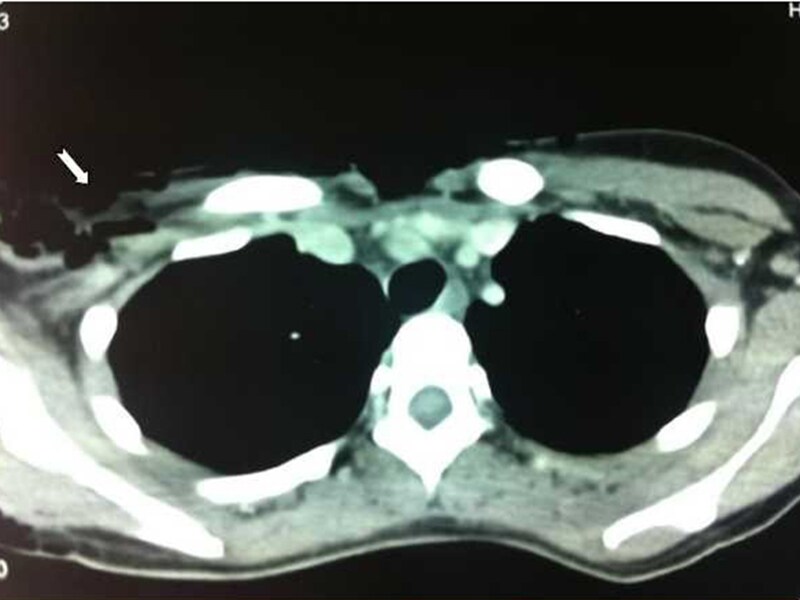Der klinische Fall: Eine 18-Jährige mit Münchhausen-Syndrom