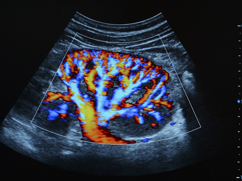 Nierenkrebs: Was zuerst – zielgerichtet oder Checkpoint-Blockade?