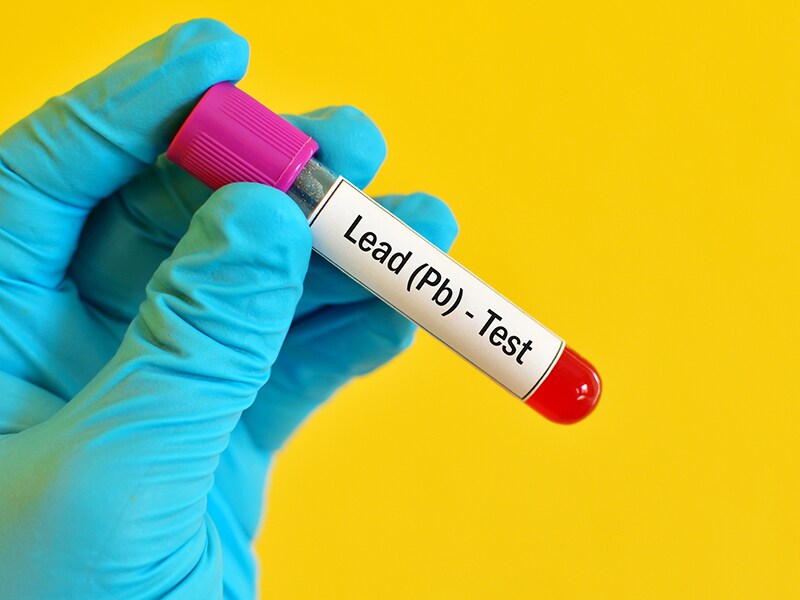 Umweltgift Blei: Stirbt jeder 5. an den Folgen einer Intoxikation?