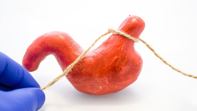 Magenbypass schon für Jugendliche? Gute Chance auf Diabetes-Remission