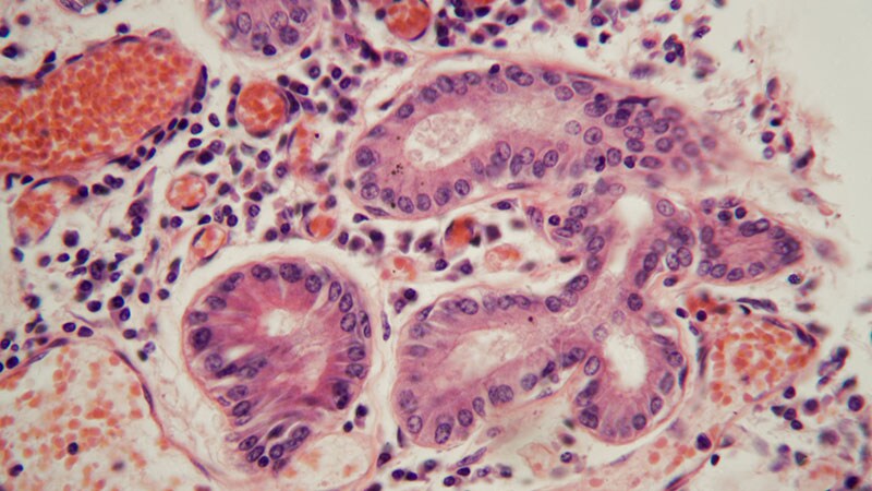 Fall: Junger Mann mit Thorax-Schmerz und Atemnot nach Darm-OP - Page 4