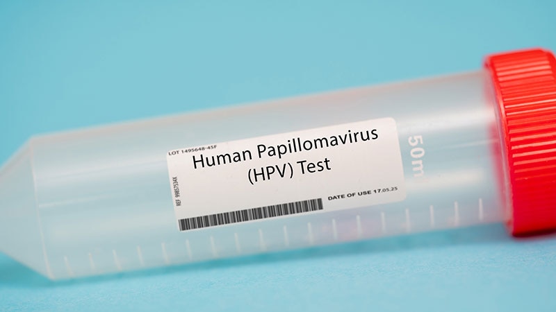 Metaanalyse zeigt überraschend hohe HPV-Prävalenz bei Männern