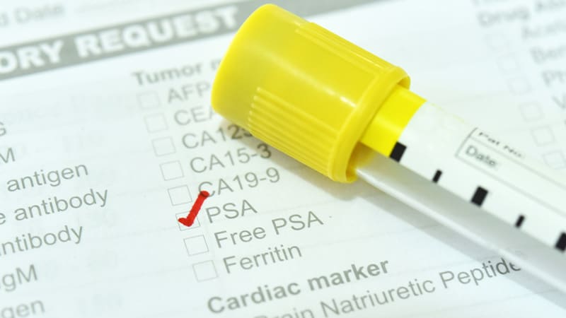 Prostatakrebs-Früherkennung: Aktualisierte S3-Leitlinie fordert PSA ...