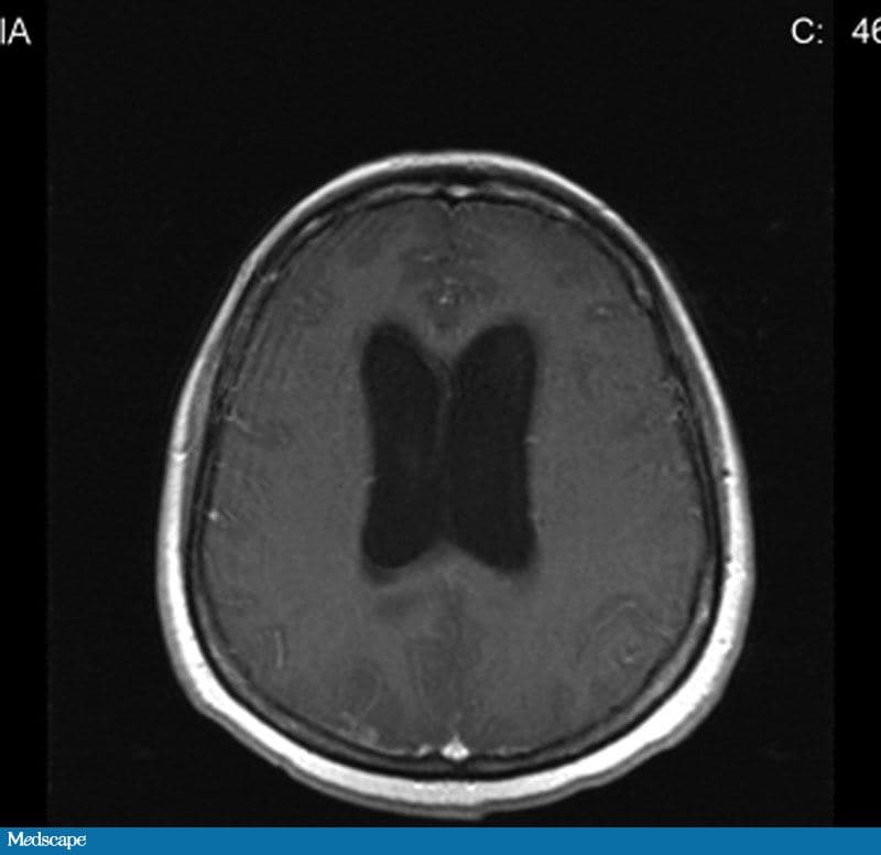 Caso Clínico: Letargia en una mujer de 52 años - Page 2