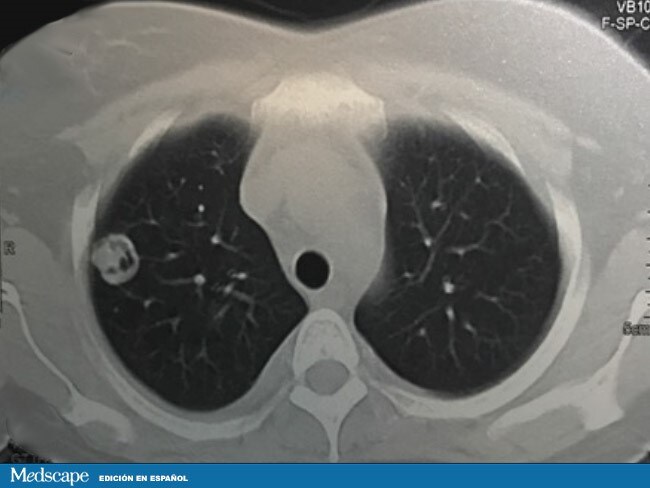 Caso Clínico: Multigesta añosa con astenia, adinamia y melena - Page 2