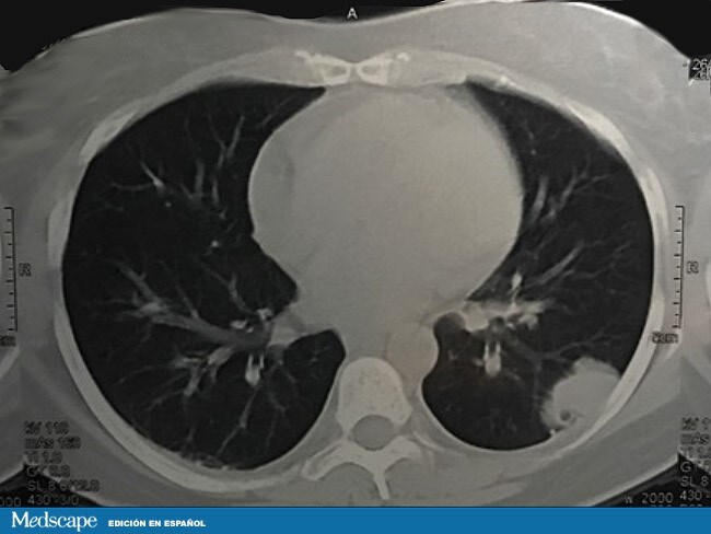 Caso Clínico: Multigesta añosa con astenia, adinamia y melena - Page 2