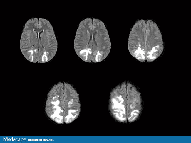 Caso Clínico: Agnosia visual en una mujer previamente sana - Page 2