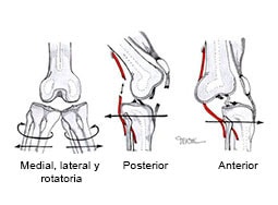 Mini Examen Clínico: Luxaciones de la rodilla - Page 2