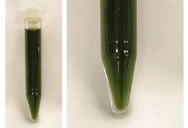 11 causas de cambio de color de la orina