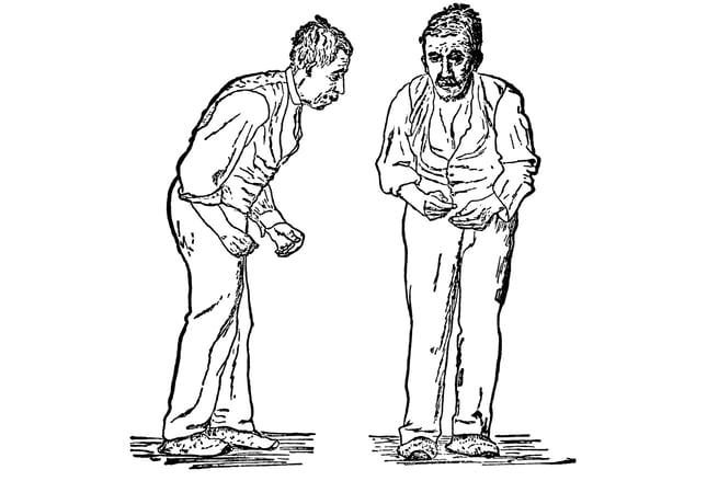 Trastornos de la marcha: Cuando el paciente no camina en línea recta