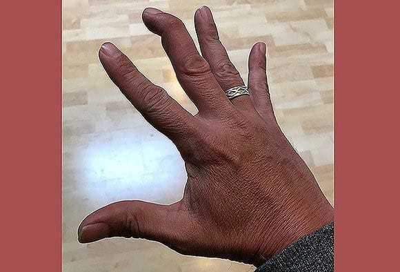 14 urgencias de la mano que no se pueden pasar por alto