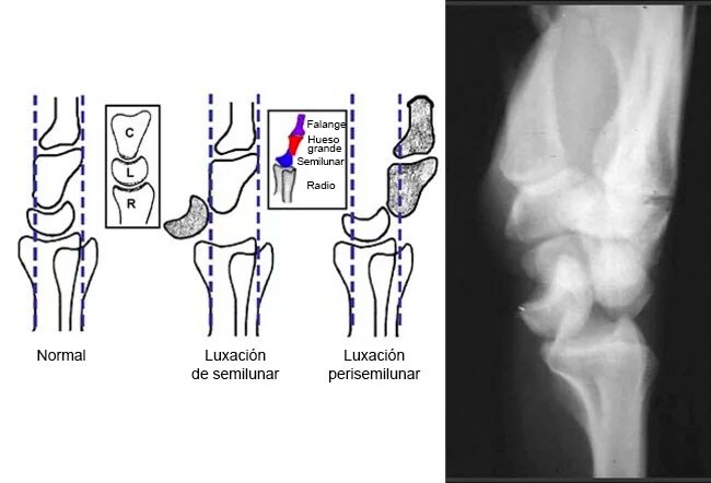 14 urgencias de la mano que no se pueden pasar por alto