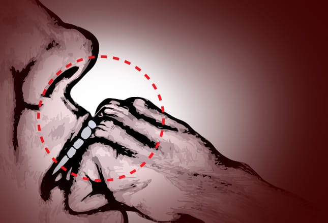 14 urgencias de la mano que no se pueden pasar por alto