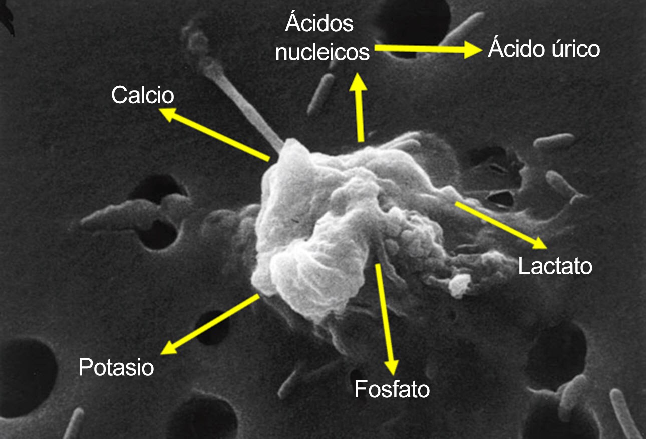 11 urgencias oncológicas que debe conocer