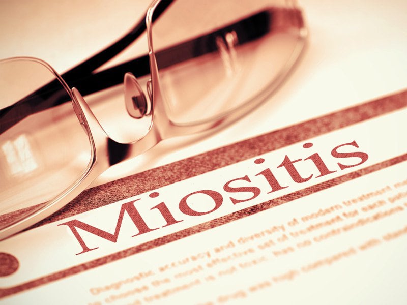 El uso de estatinas se vinculó a miositis inflamatoria idiopática