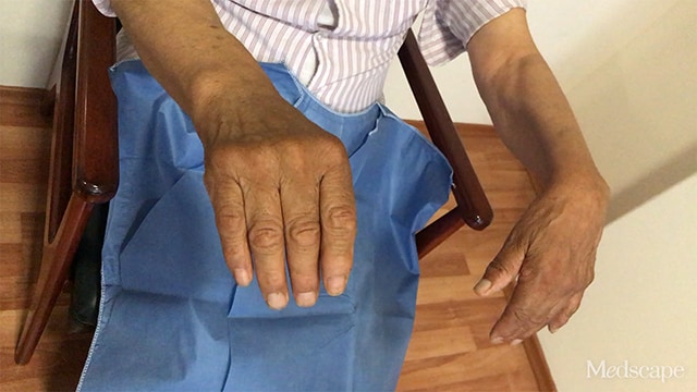 El rincón de la Neurología: Manos inquietas (Transcript)