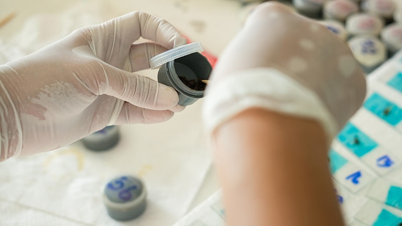 Prueba fecal no invasiva es eficaz para el cribado en cáncer de colon