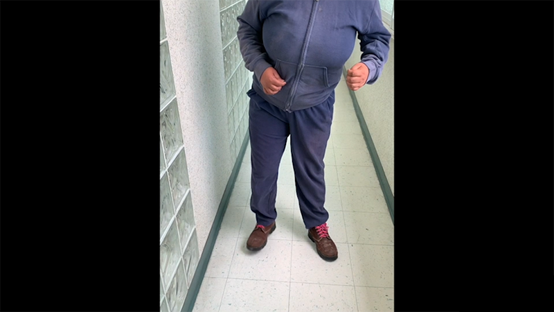 El rincón de la Neurología: Secuelas de eclampsia (Transcript) - Page 2