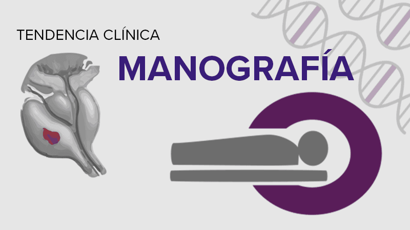 Tendencia Clínica: Manografía