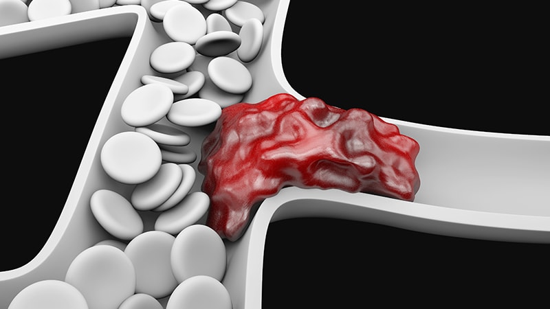 70% de los pacientes hospitalizados que desarrollan embolia pulmonar ...