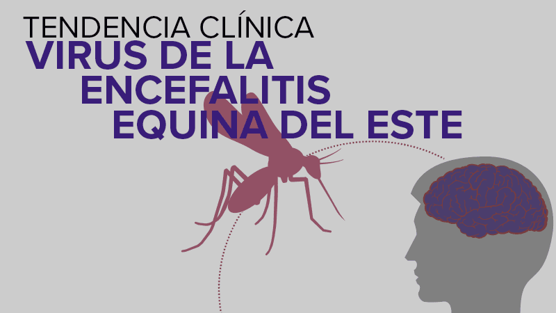 Tendencia Clínica: Virus de la encefalitis equina del este