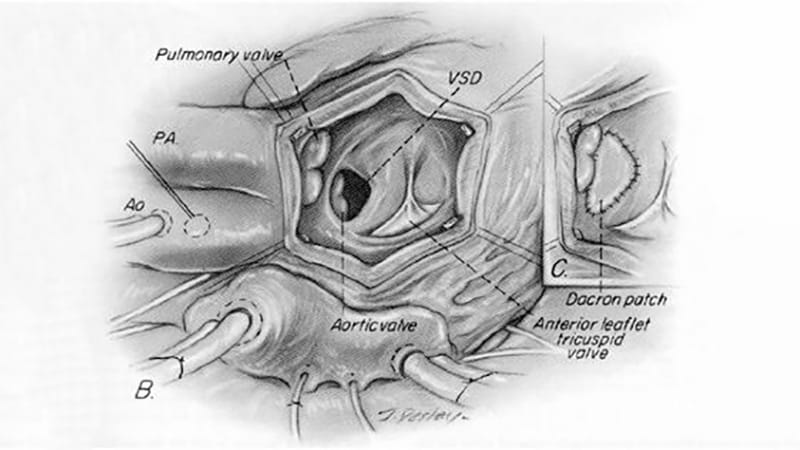 Mini Examen Clínico: Comunicación interventricular - Page 4
