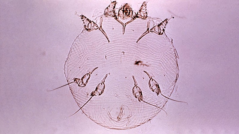 Aumento de casos de escabiosis en España: consejos para pacientes y ...