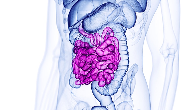 Mini-examen clínico: Obstrucción del intestino delgado