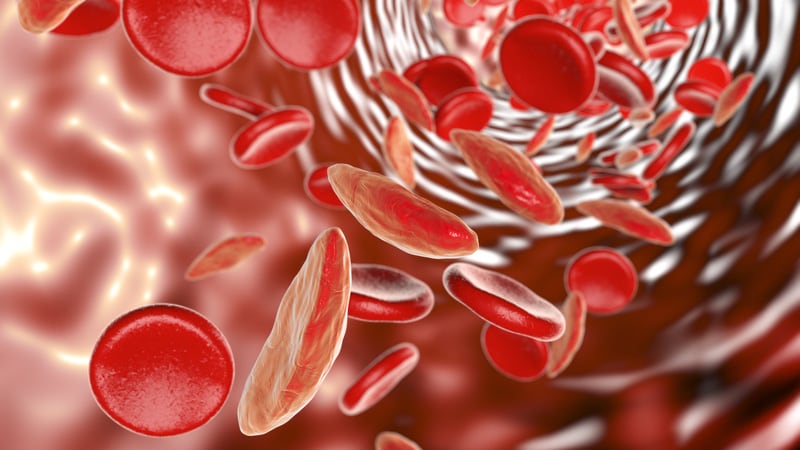 Progreso, no cura, para la anemia de células falciformes, según un ...