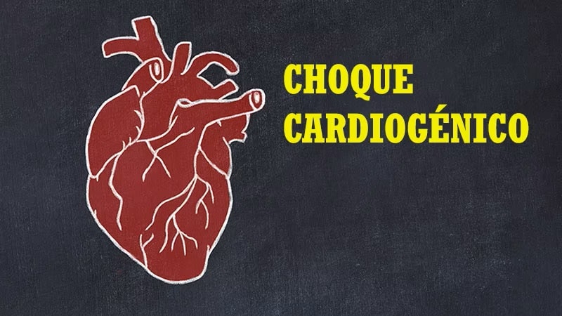 Bomba de apoyo ventricular mejora la sobrevida en el infarto y el ...