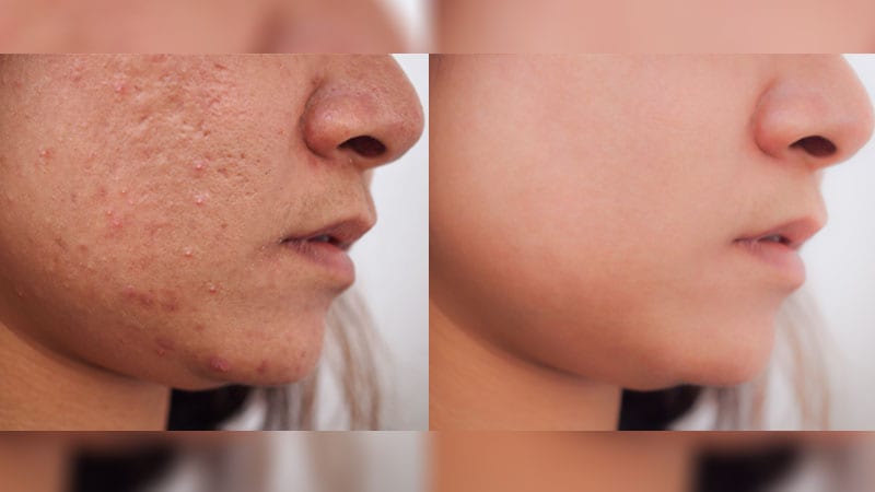 Medicina General - Medscape