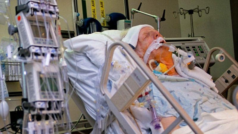 Apnea obstructiva del sueño grave y mal pronóstico en ictus