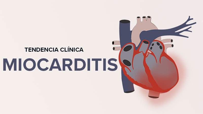 Tendencia clínica: Miocarditis