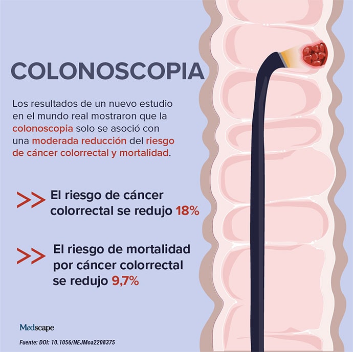 Tendencia clínica: Colonoscopia