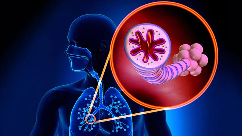 Sepsis: mayor riesgo de mortalidad intrahospitalaria en enfermedad ...