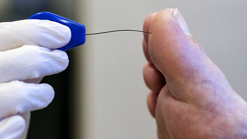 Mini-examen clínico: Tratamientos de la neuropatía diabética