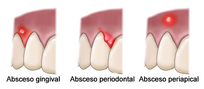 Caso clínico: Paciente masculino con hipertensión y cambios de ...