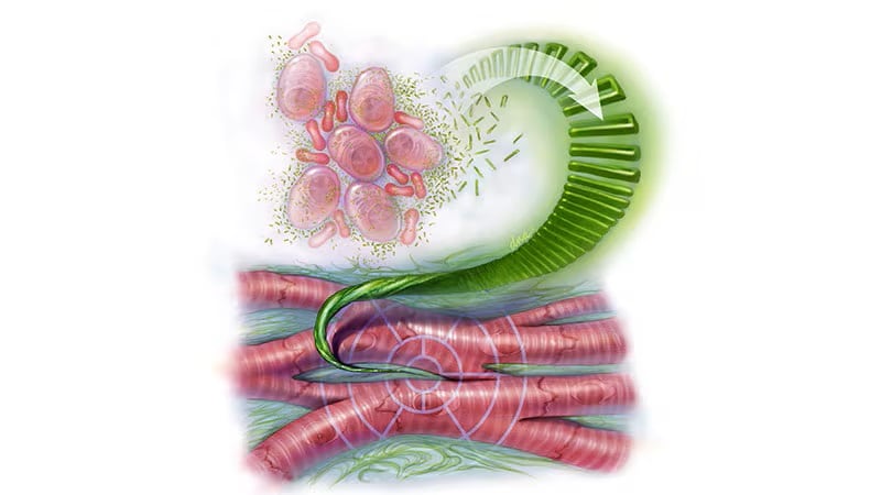 Amiloidosis hereditaria: 5 datos que hay que saber