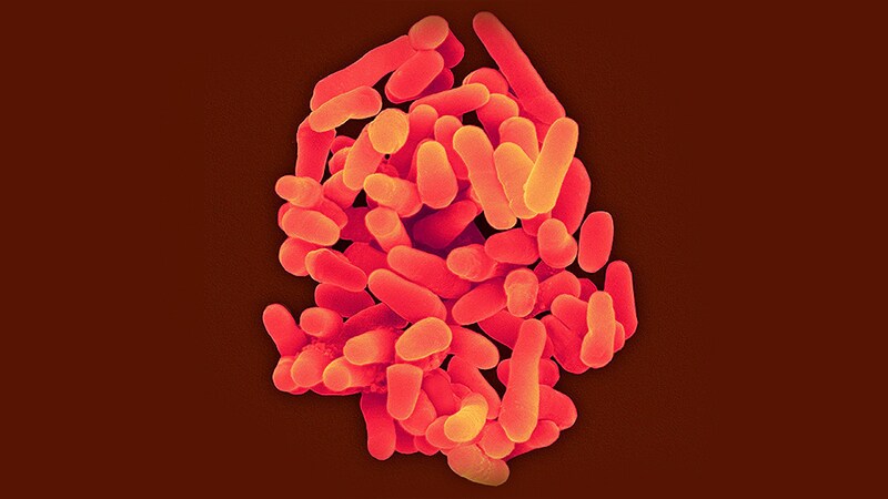 ¿Tuberculosis extrapulmonar en pacientes inmunodeprimidos con y sin ...