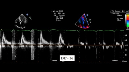 Le cas clinique en images du Dr Malergue : cas 29