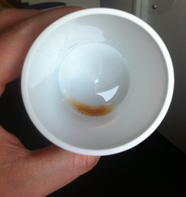 Cas clinique: patient de 72 ans avec toux et expectoration soudaines