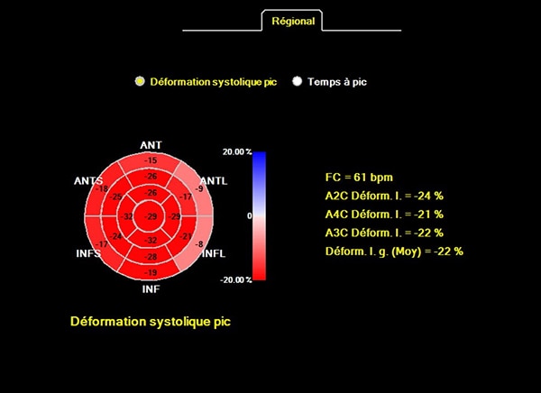 Cas clinique: perte de conscience chez un jeune sportif