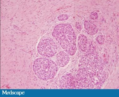 Cas clinique : jeune fille avec anémie et stéatorrhée - Page 3