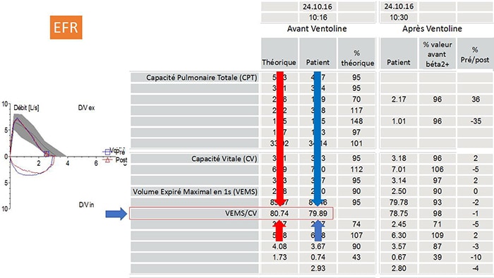 Cas clinique: épisodes de dyspnée sifflante et de bronchites à ...